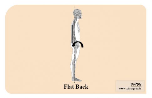 ناهنجاری های شایع وضعیت بدن و بهترین وضعیت بدنی | پیوجیم