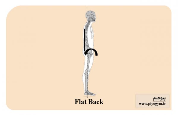 ناهنجاری های شایع وضعیت بدن و بهترین وضعیت بدنی | پیوجیم
