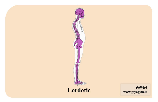 ناهنجاری های شایع وضعیت بدن و بهترین وضعیت بدنی | پیوجیم